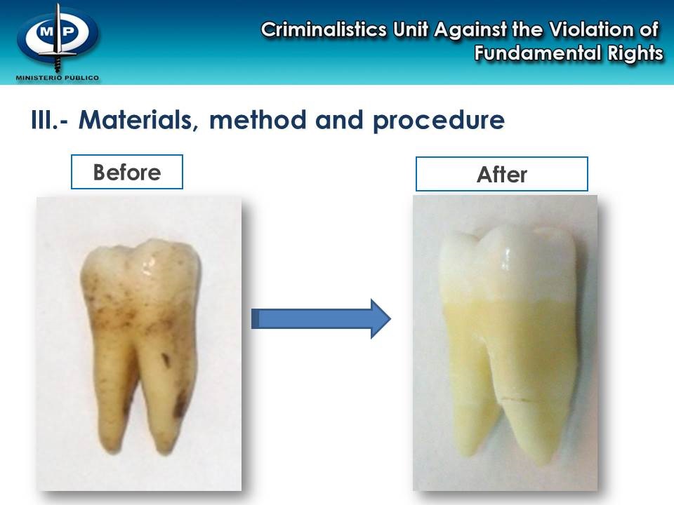 Criminalística | Novel Technique of Dental Tissue Collection for ...